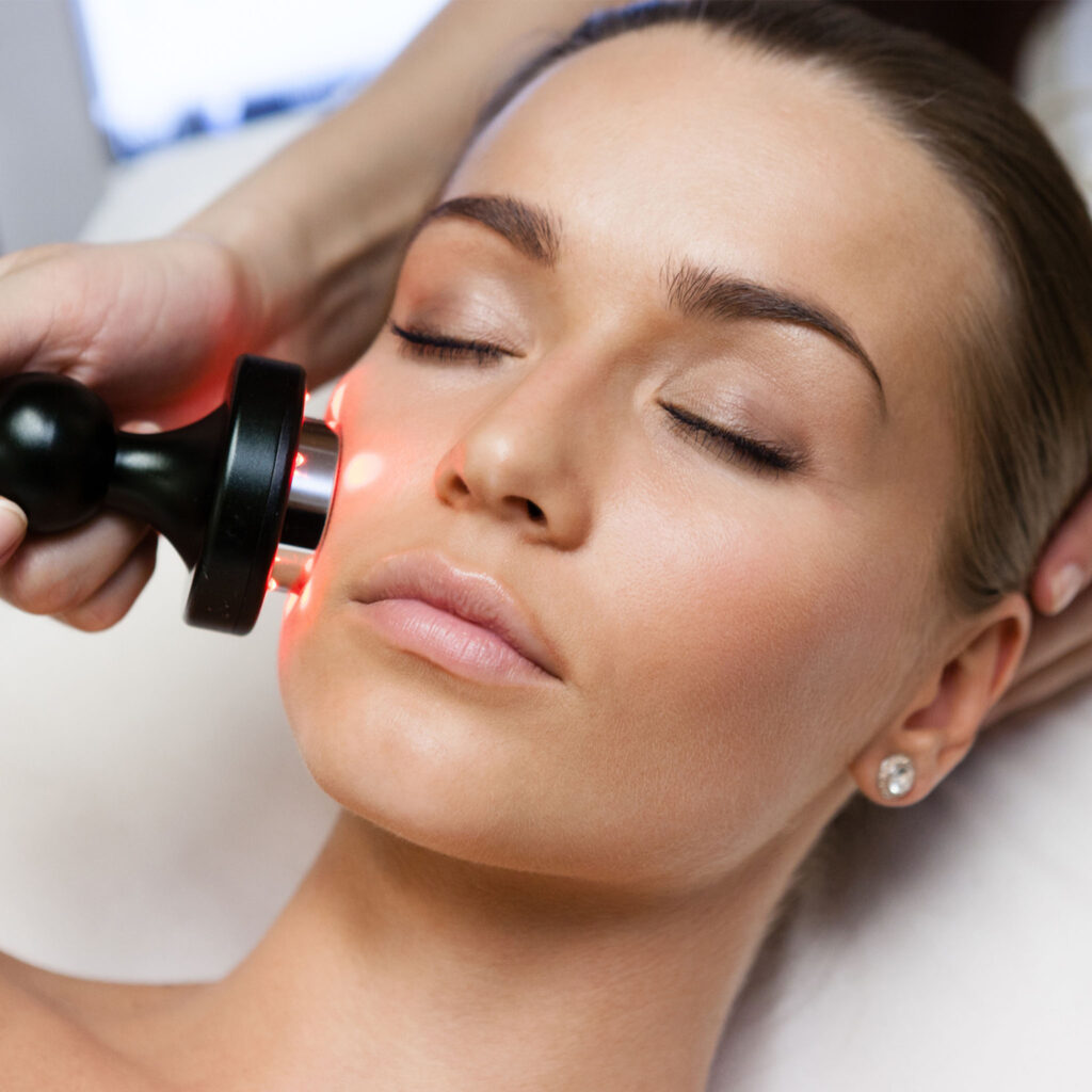 Laser Photofacials - Cypress Dermatology